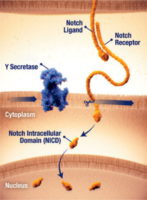 Desmoid Tumours: About Desmoid Tumours | SpringWorks Therapeutics